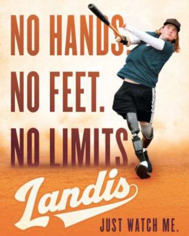 Landis: Just Watch Me - Dove.org